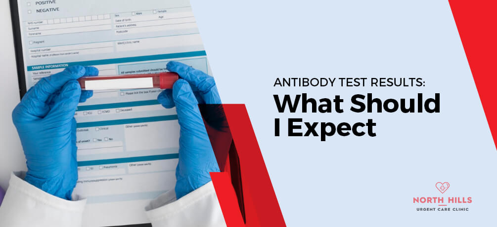 Antibody Test Results Expectations